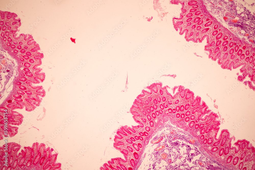 Poster Tissue of Small intestine (Duodenum), Large intestine Human and ...
