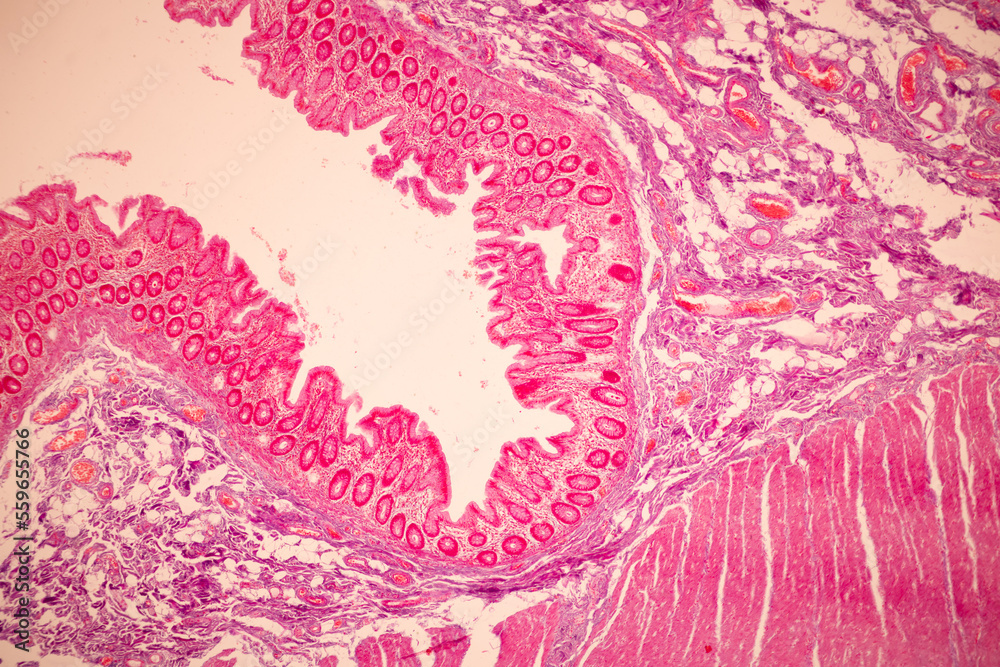 Tissue of Small intestine (Duodenum), Large intestine Human and Stomach ...