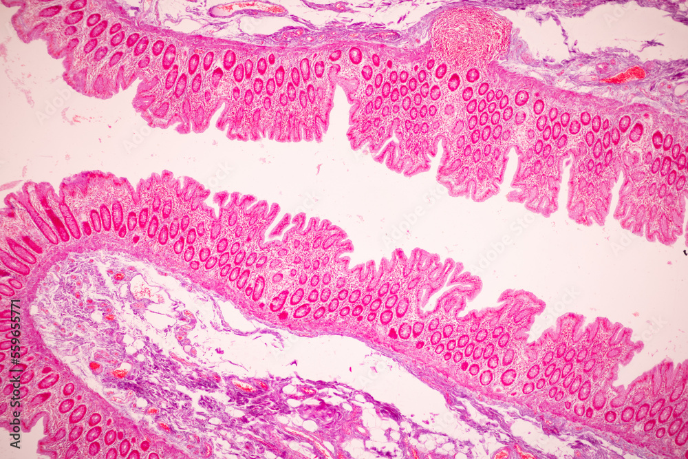 Tissue of Small intestine (Duodenum), Large intestine Human and Stomach ...
