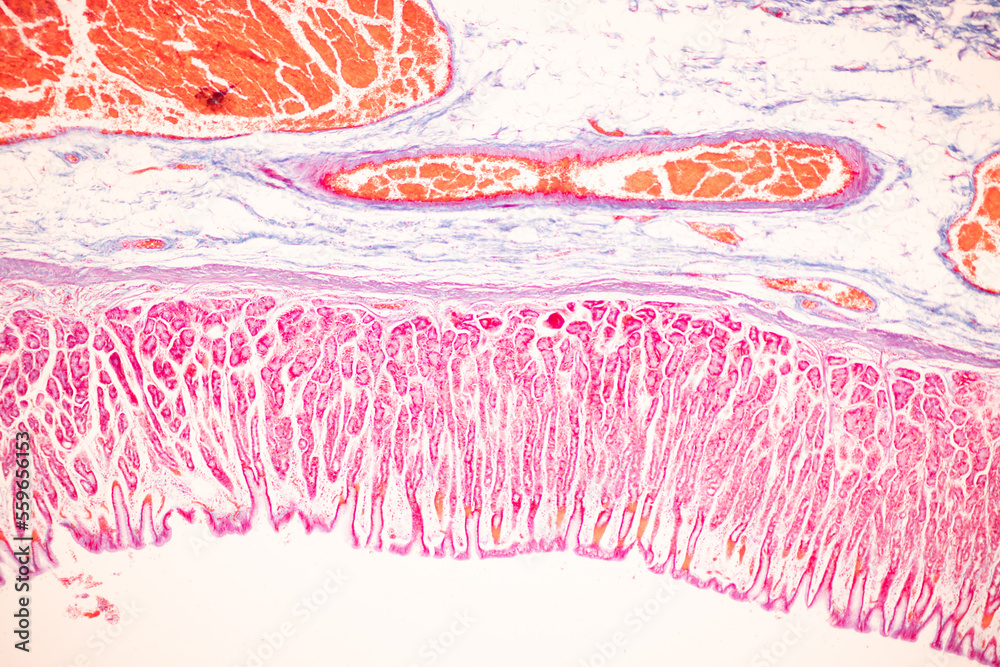 Tissue of Small intestine (Duodenum), Large intestine Human and Stomach ...