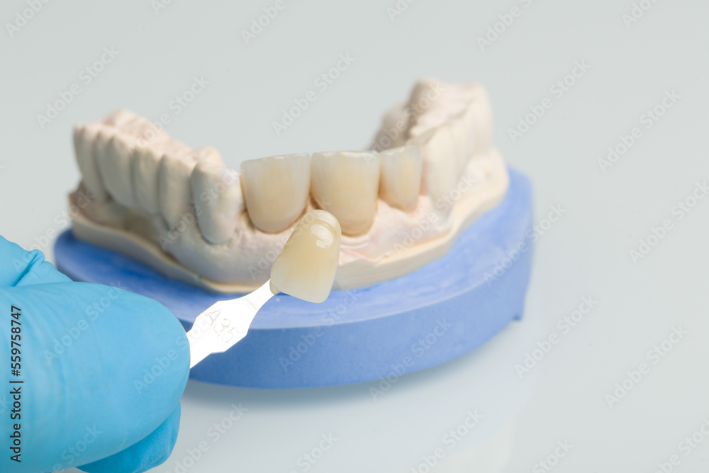 Dental imprint with artificial dentition and tools in a dental ... Dental imprint with artificial dentition and tools in a dental ...