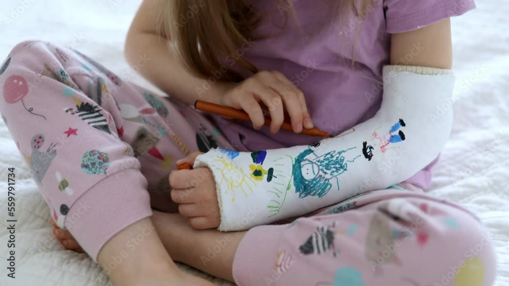Adorable preschooler girl with a broken arm at home on the bed draws ...