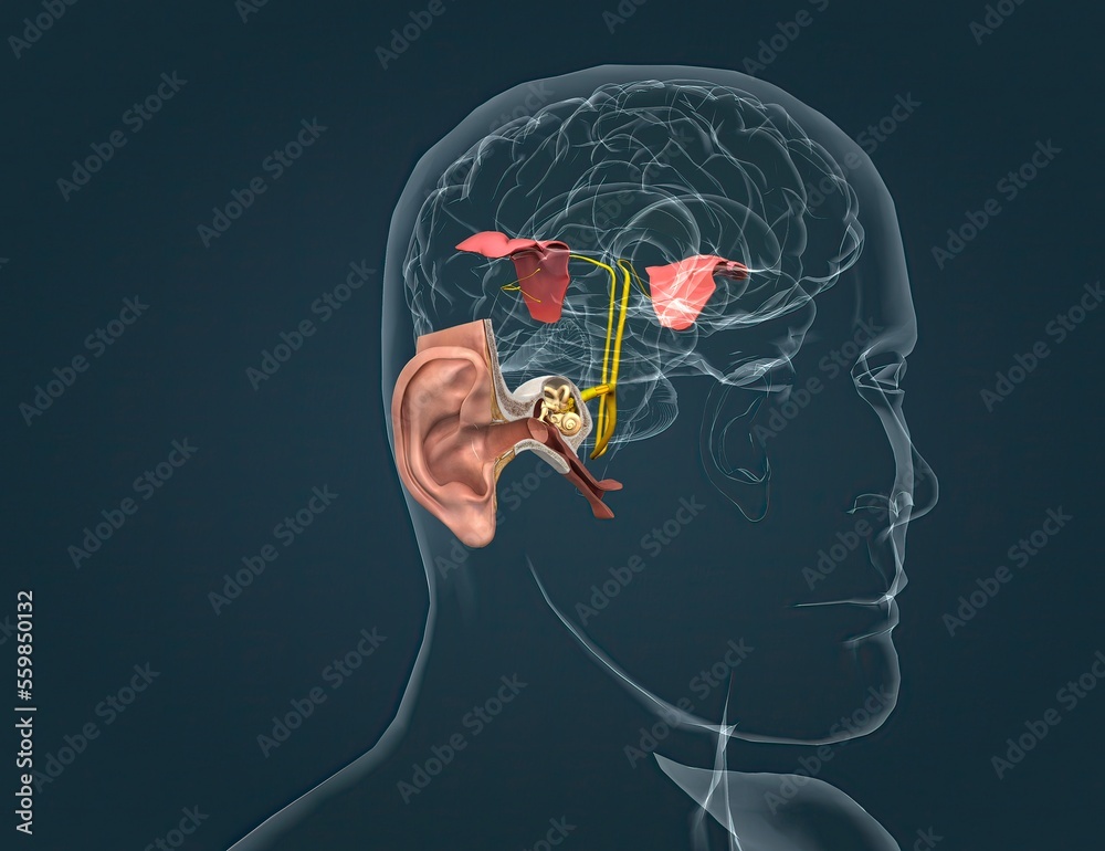 Sound passes through the ear and carries signals to the brain stem ... Sound passes through the ear and carries signals to the brain stem ...
