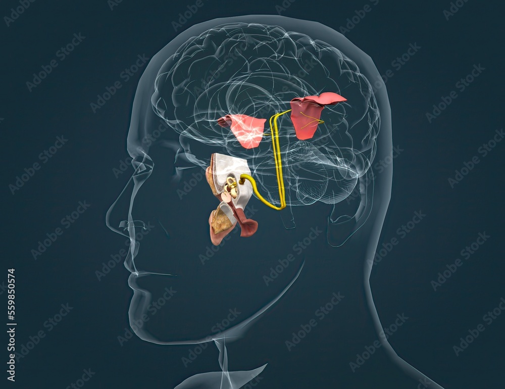 Sound passes through the ear and carries signals to the brain stem ... Sound passes through the ear and carries signals to the brain stem ...