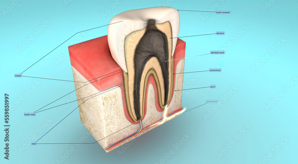 Anatomy of the tooth and gums and the supporting structures surrounding ...