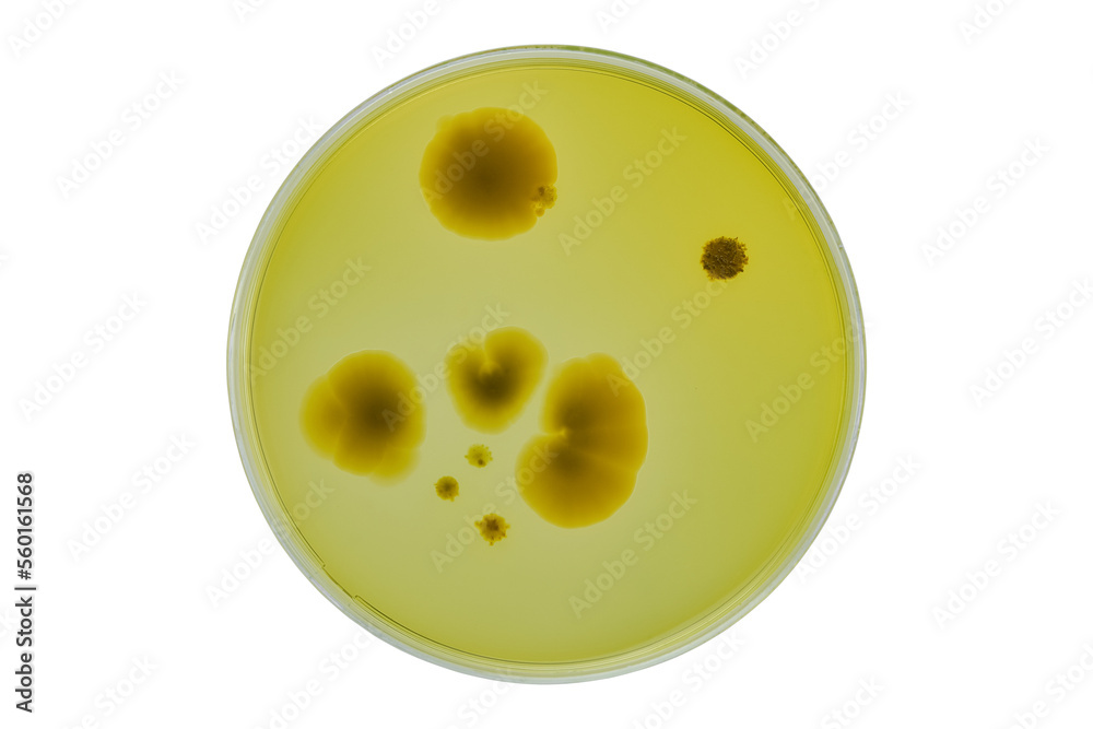 Petri dish or culture media with bacteria on white background with ...