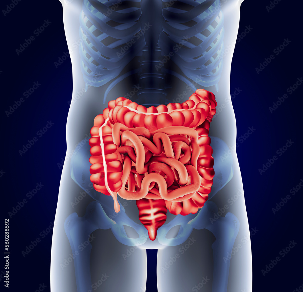 Large and small intestine. Colon cancer, bacteria, virus in the ...