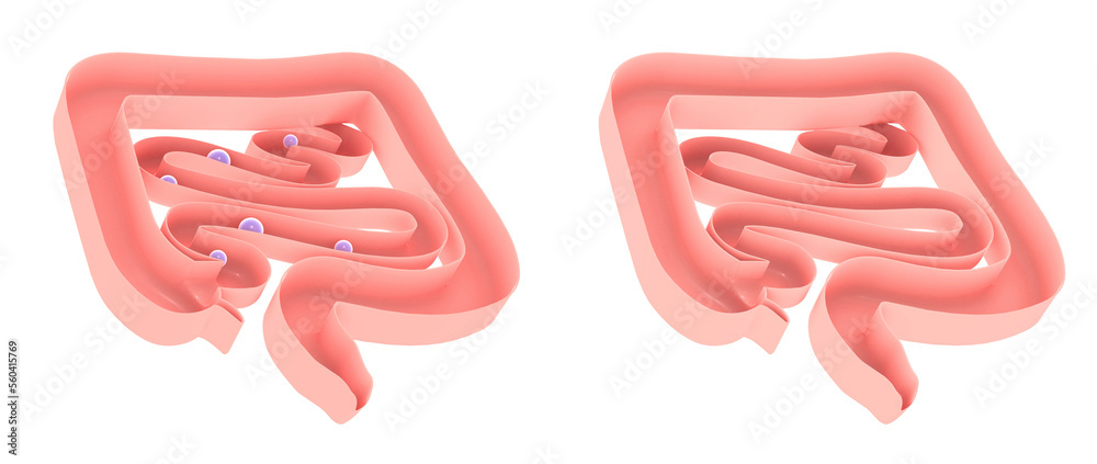 Anatomical 3d illustration of the digestive system, with gases in the ...