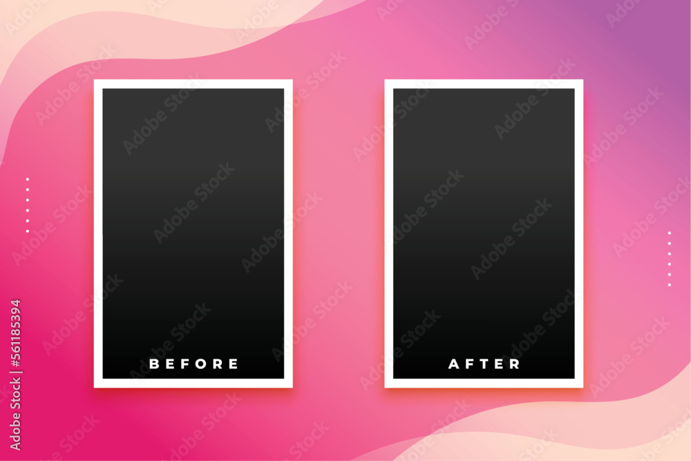 comparison before and after photo frame gradient background Stock ...