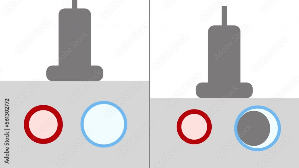 Animation Showing Ultrasound Compression for Detecting of Deep Vein ...