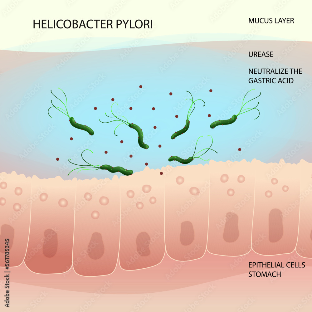 Helicobacter pylori bacteria in mucosal layer of human stomach Stock ...