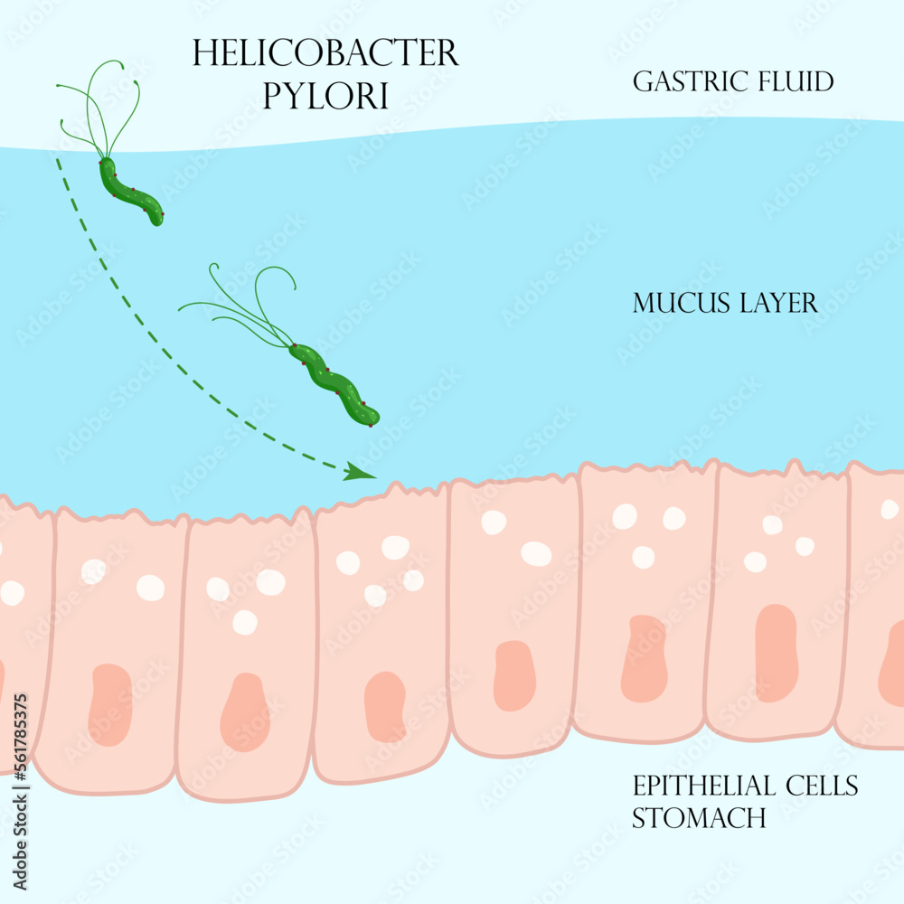 Helicobacter pylori in mucosal layer in stomach illustration Stock ...