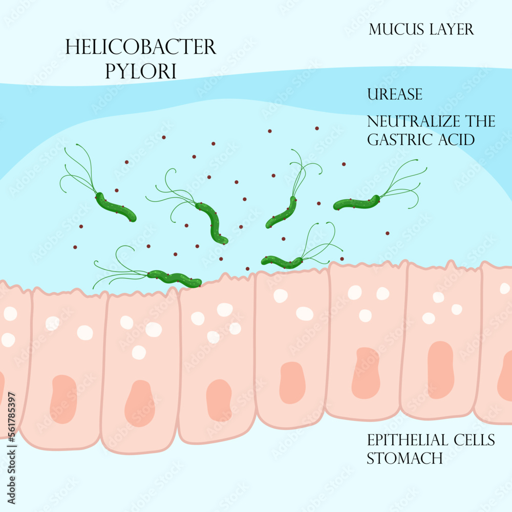 Helicobacter pylori in mucosal layer on epithelial cells in stomach Stock Vector | Adobe Stock