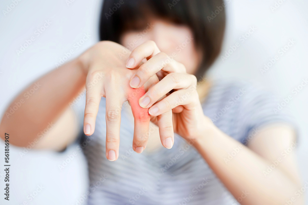 Women with osteoarthritis of the knuckle experience a lot of pain in ...