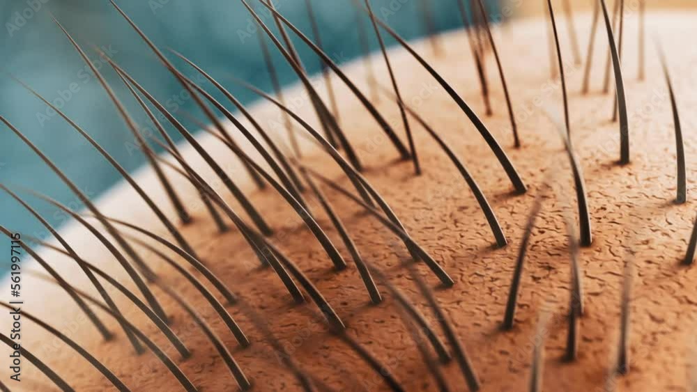 3D scene with lots of tiny hairs and skin texture. 3D Skin, Hair render ...