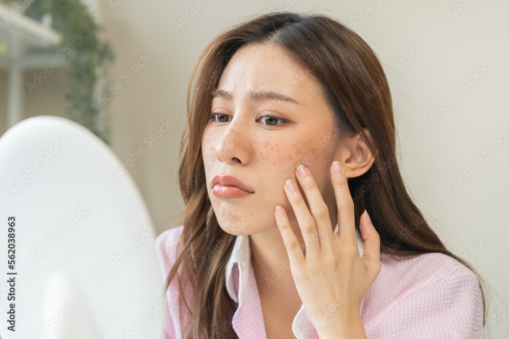 Dermatology, expression face worry, stressed asian young woman hand ...