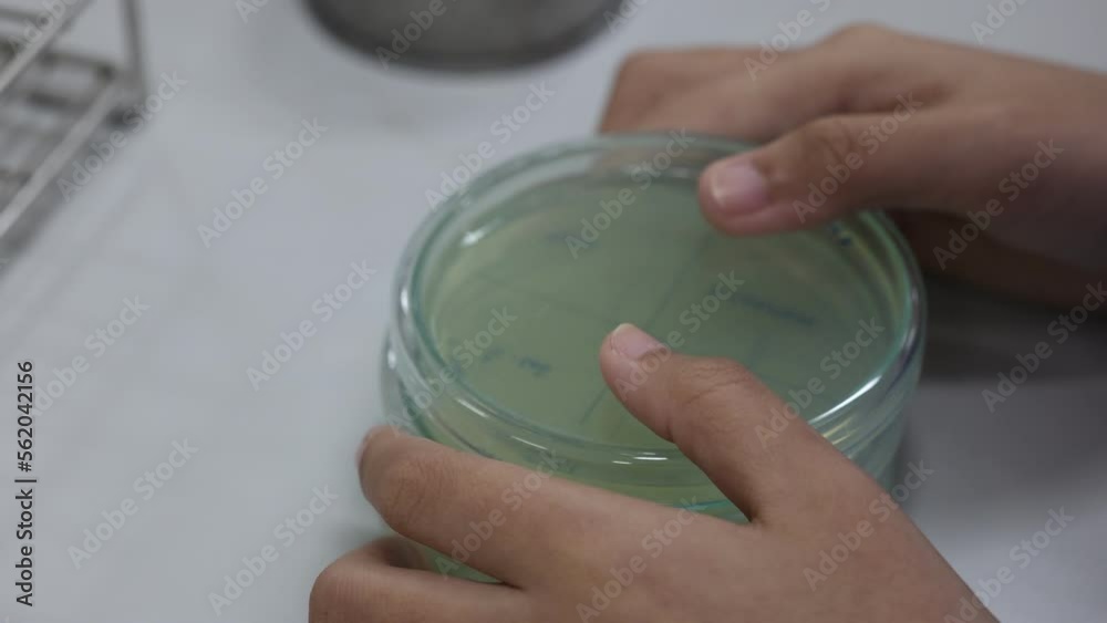 Cultivation of microorganisms on agar medium plate in microbiology ...