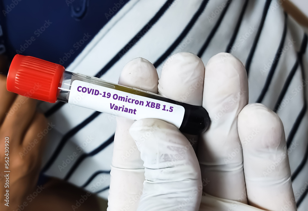 Blood sample for SARS-COV-2, COVID-19 Omicron XBB.1.5 variant test. The ...