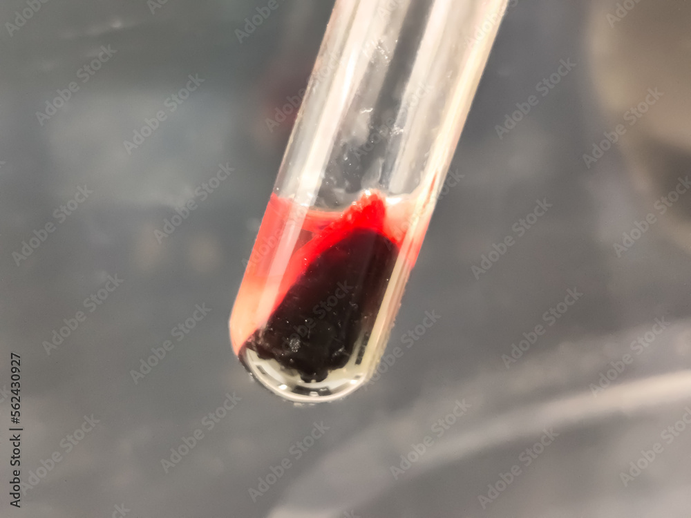 Blood sample for SARS-COV-2, COVID-19 Omicron XBB.1.5 variant test. The ...