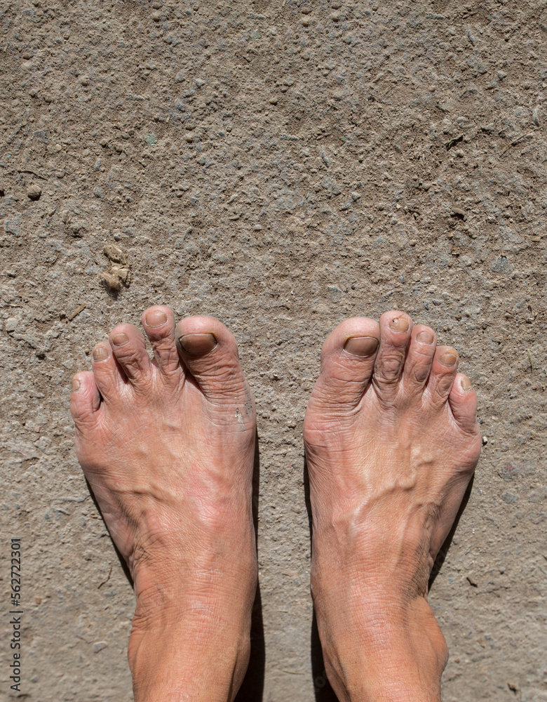Old man's feet degenerate and wrinkled skin on a concrete floor with ...