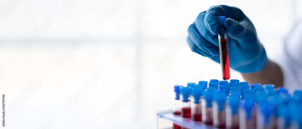 Blood test tubes. Senior male scientist examining blood test tubes at ...