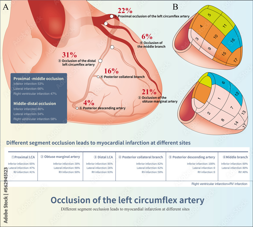 The left circumflex arterysends out different branch arteries, different segments or branch ...