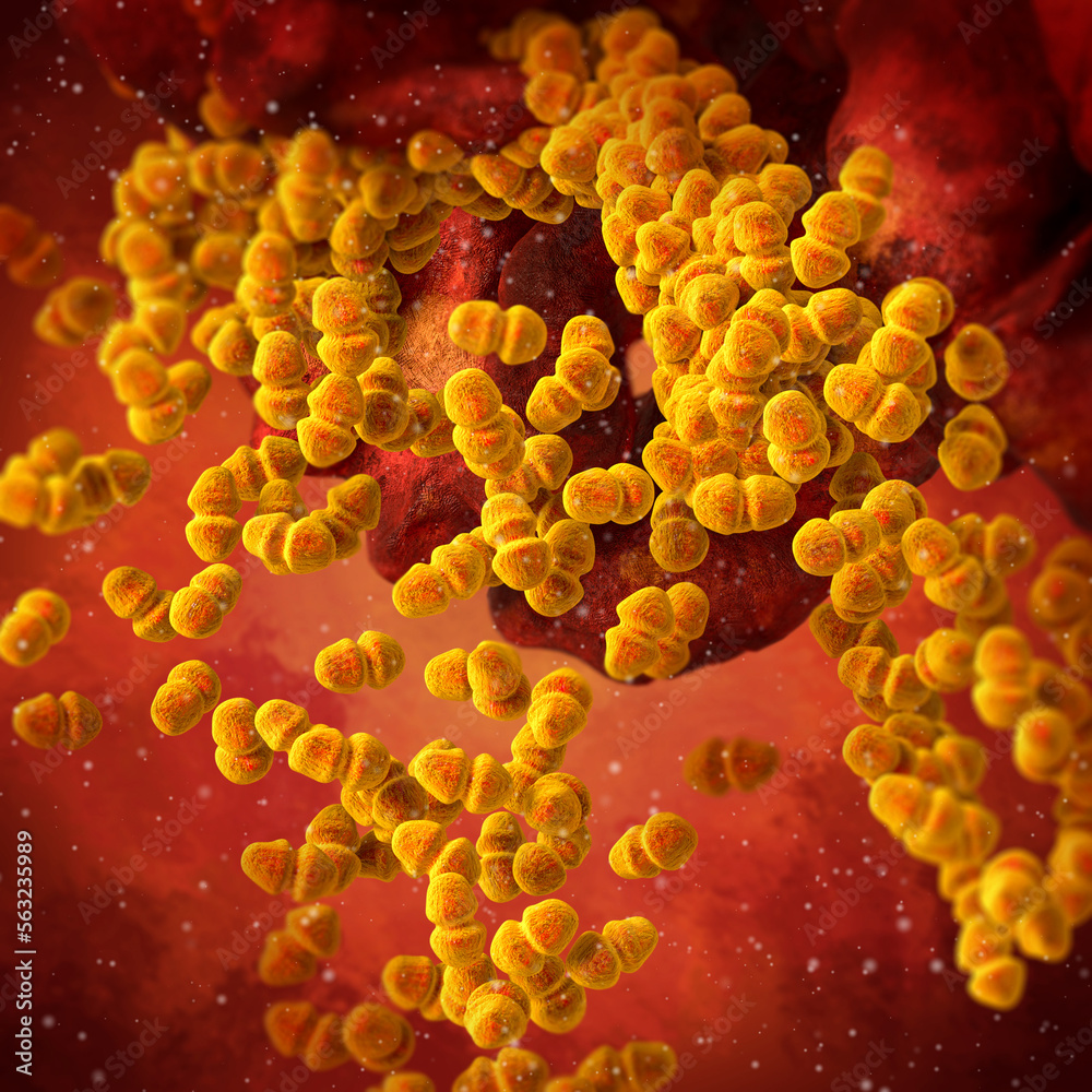 Medical background, Staphylococcus aureus, a type of spherical gram ...