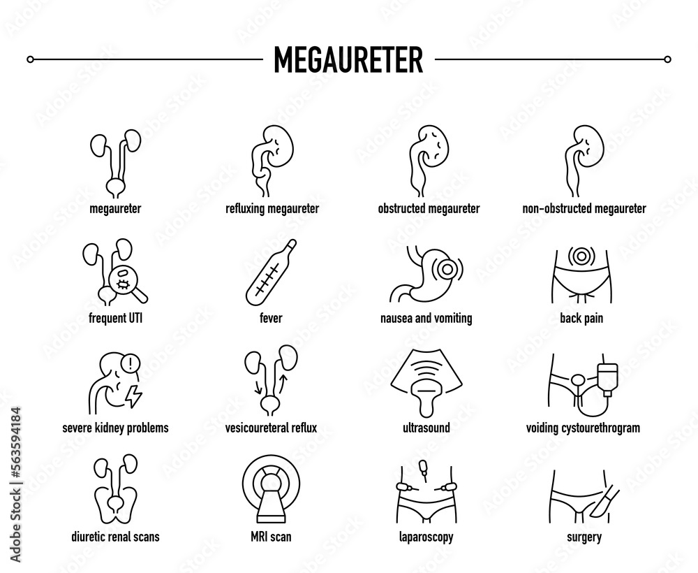 Megaureter types, symptoms, diagnostic and treatment vector icon set ...