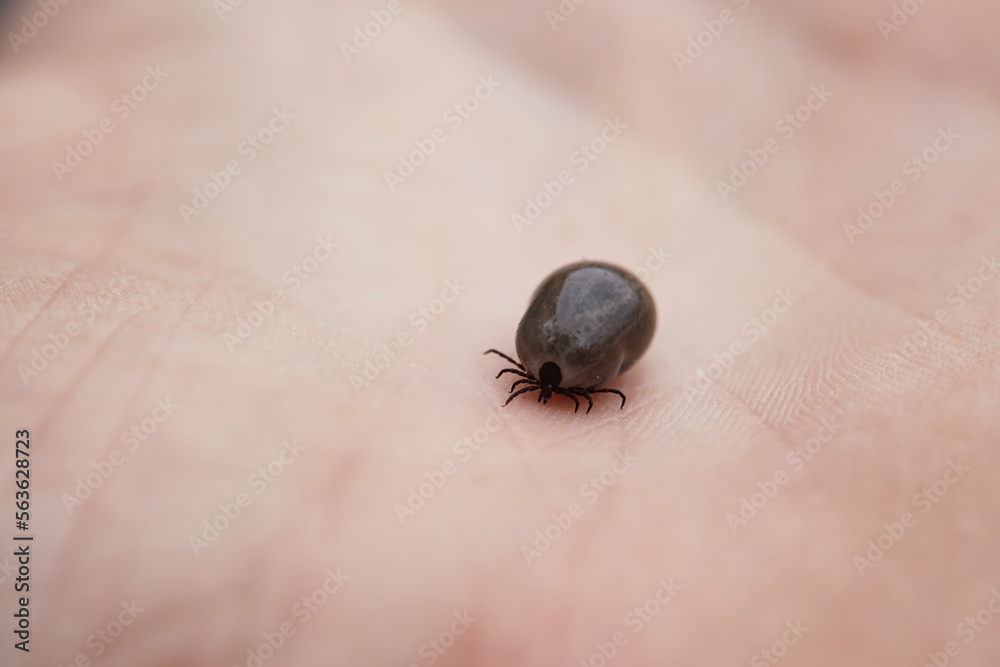 Fully fed tick on human hand. Close-up view of parasite on skin.. Stock ...