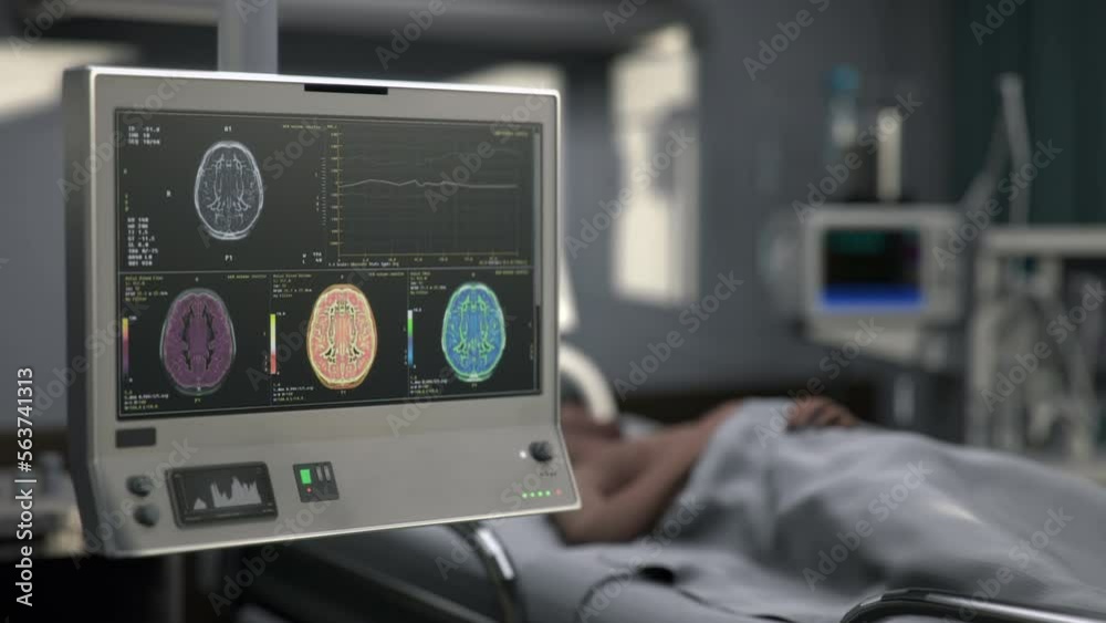 Modern Healthcare Hospital Equipment Conducts Brain Injury Scan. Scan ...