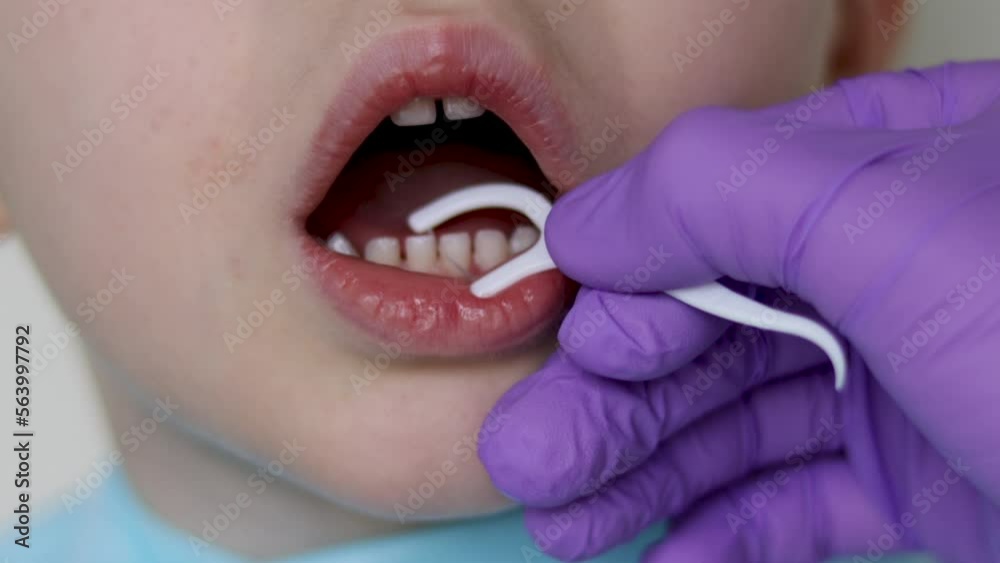 Vídeo do Stock: kid dentist visit open mouth doctor in surgical purple ...