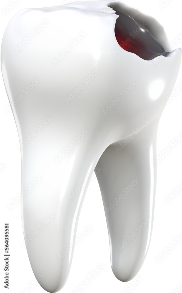 Tooth decay 3D icon. Stock Illustration | Adobe Stock