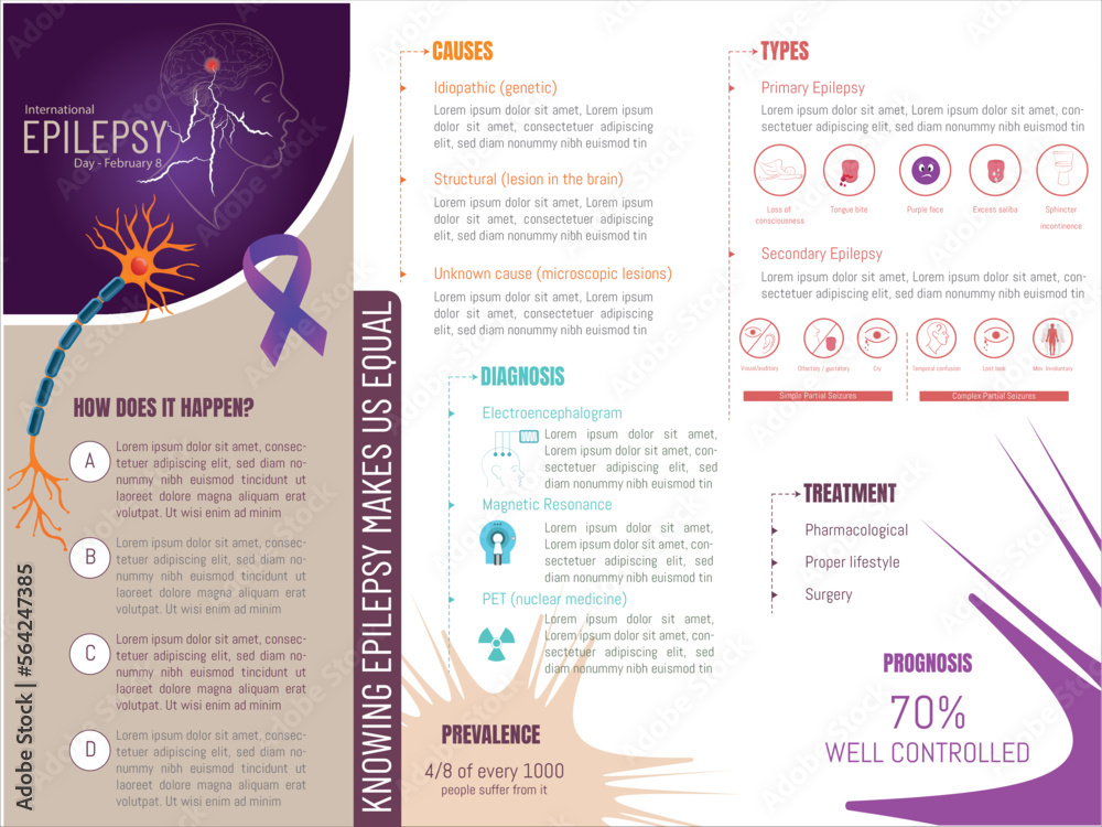 Vecteur Stock Infographic about epilepsy, causes, types, diagnosis and ...