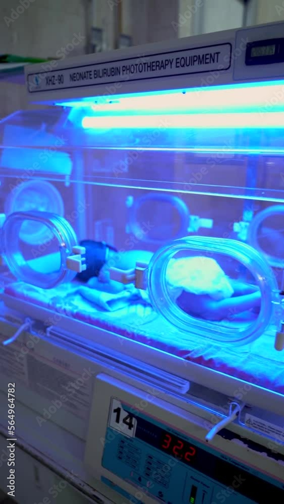 Newborn having a treatment for jaundice under ultraviolet light, Baby ...