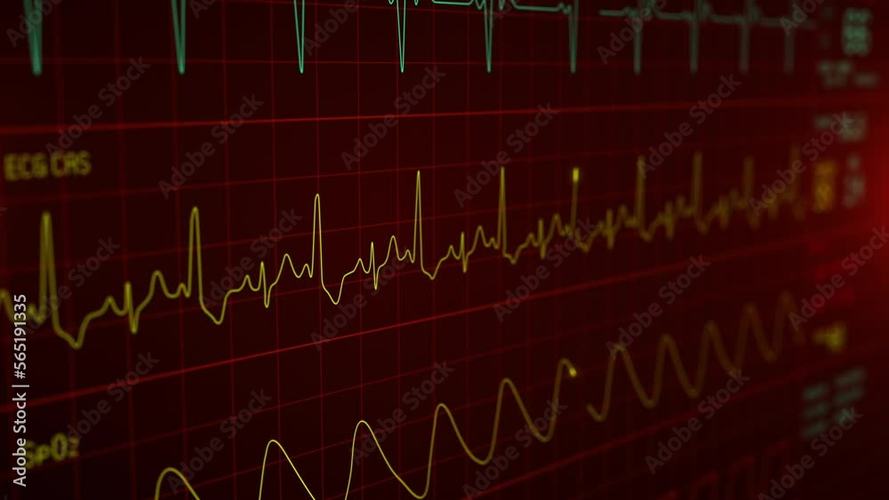 Video „Patient monitor displays vital signs ECG electrocardiogram EKG ...