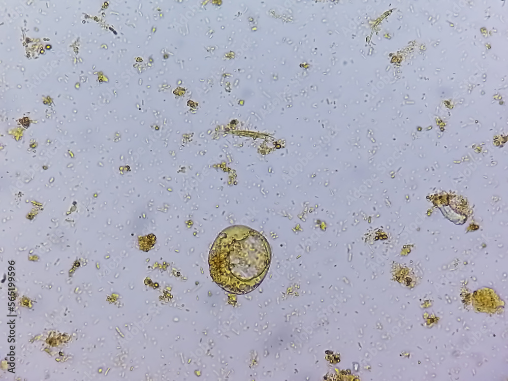 Microscopic examination of Stool showing Blastocystis hominis parasite ...
