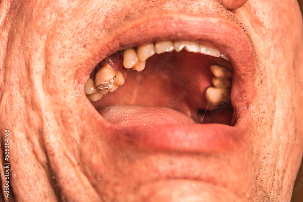 Foto Stock Close up man open mouth, jaw with teeth, detailed sealed ...