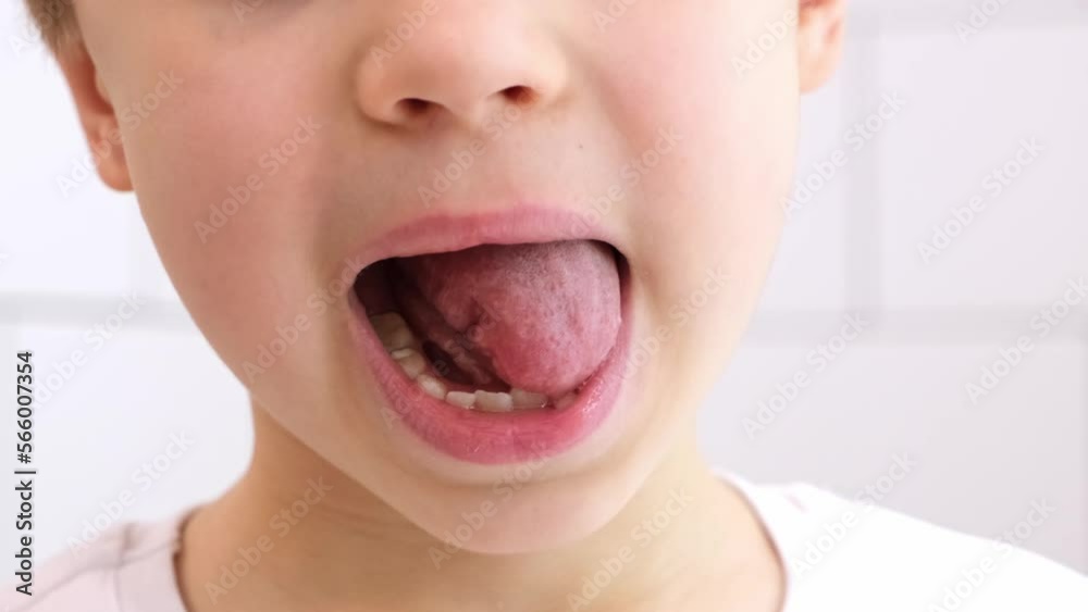 Child shows his loose milk tooth presses and pushes it with his tongue ...
