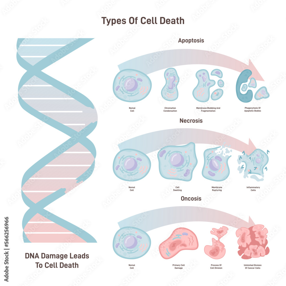 Cell death types: general differences between cell death processes ...