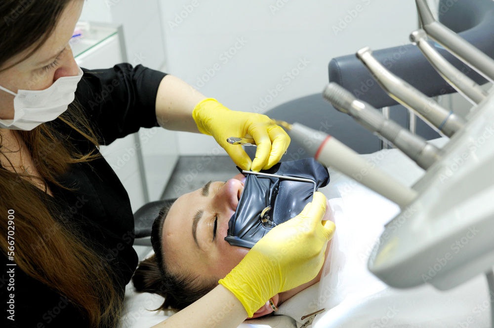 cofferdam clamp for cofferdam The process of dental prosthetics using ...