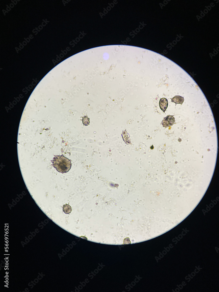 Notoedres cati under the microscope. Notoedric mange, also referred to ...