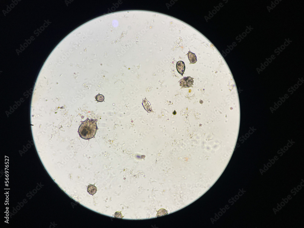 Notoedres cati under the microscope. Notoedric mange, also referred to ...
