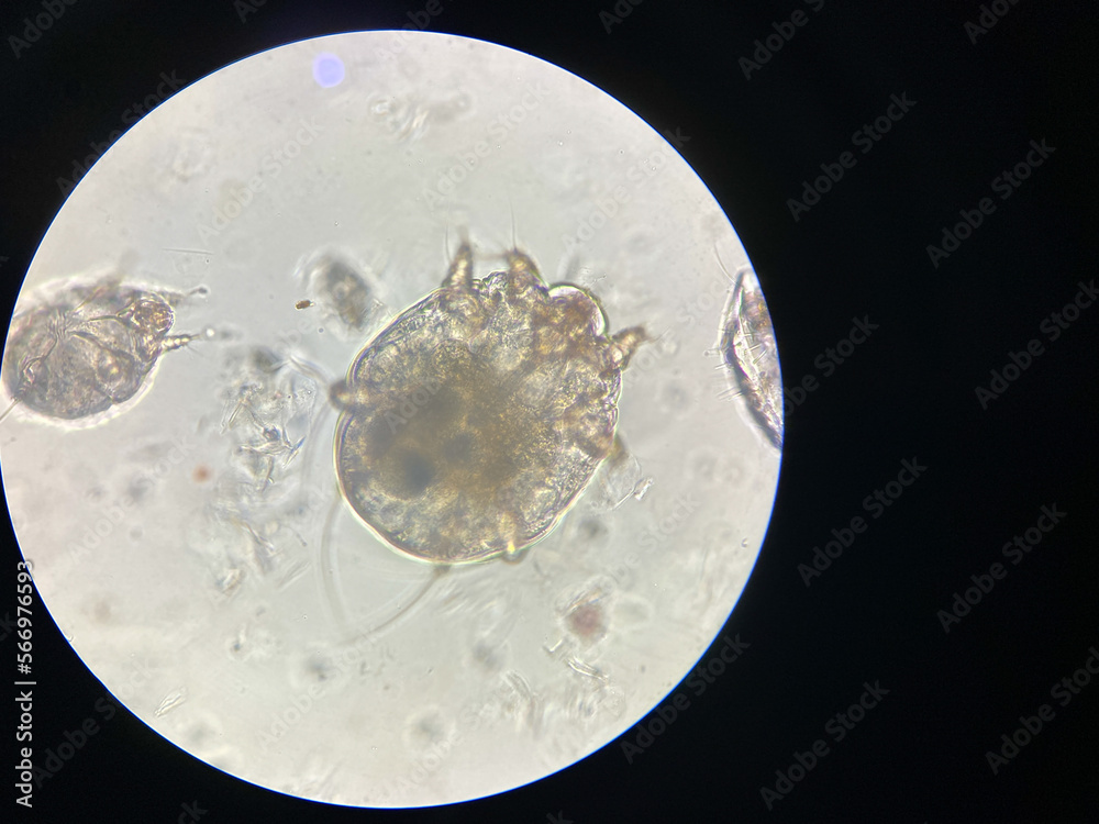 Notoedres cati under the microscope. Notoedric mange, also referred to ...