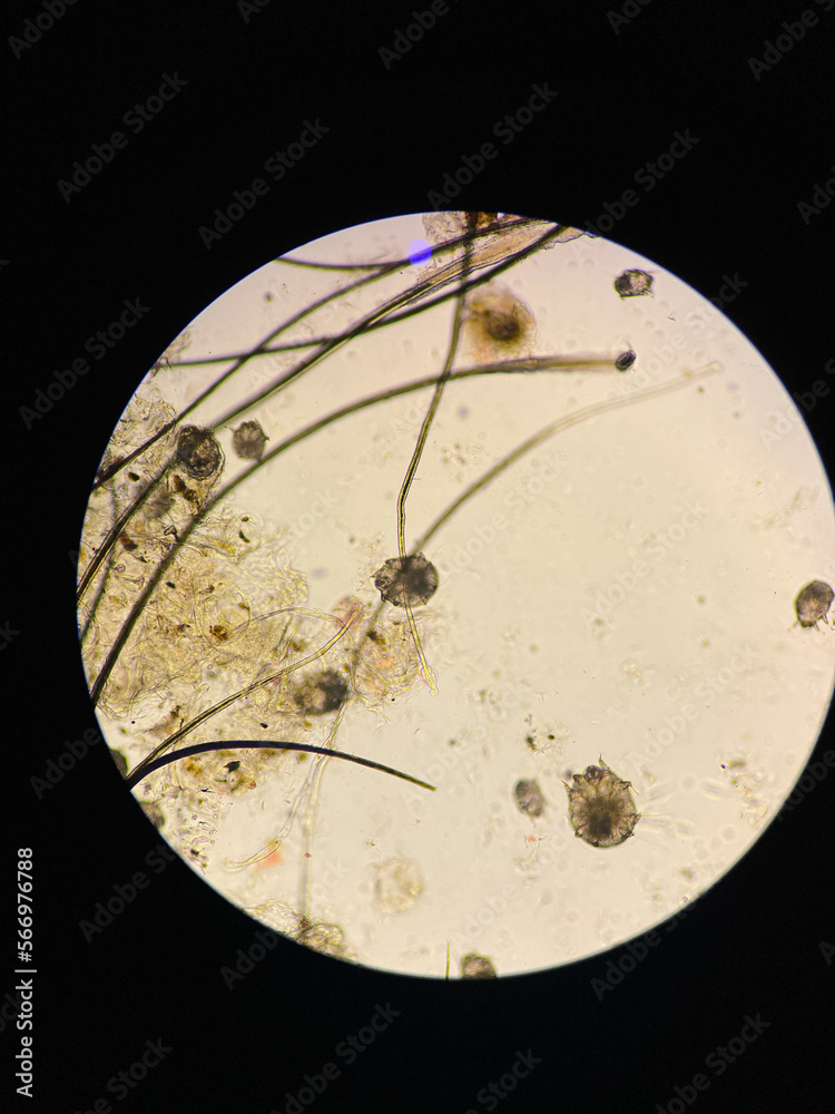 Notoedres cati under the microscope. Notoedric mange, also referred to ...