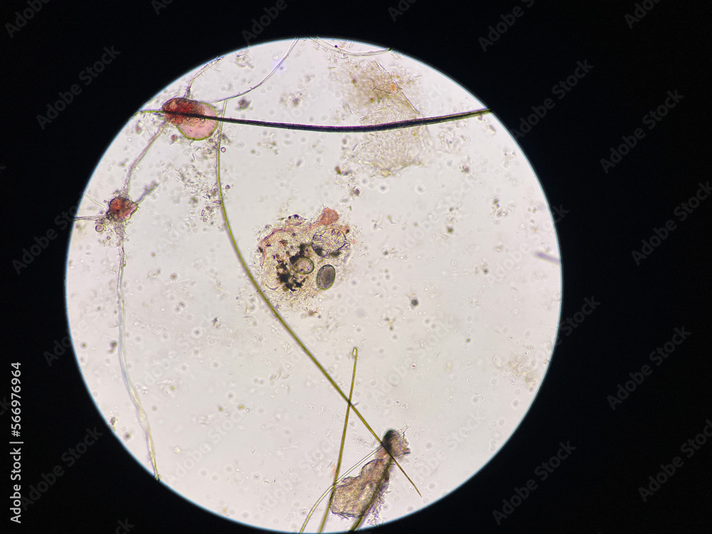 Scabies Eggs Under Microscope
