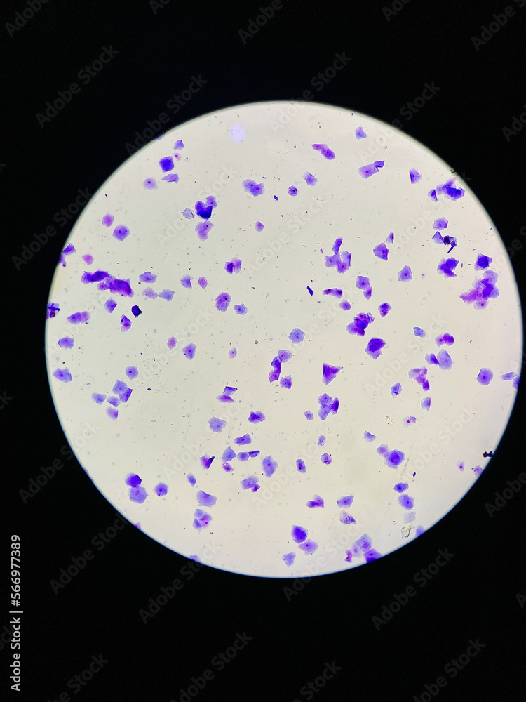 View in microscopic of dog vaginal smear cells.Squamous epithelium ...