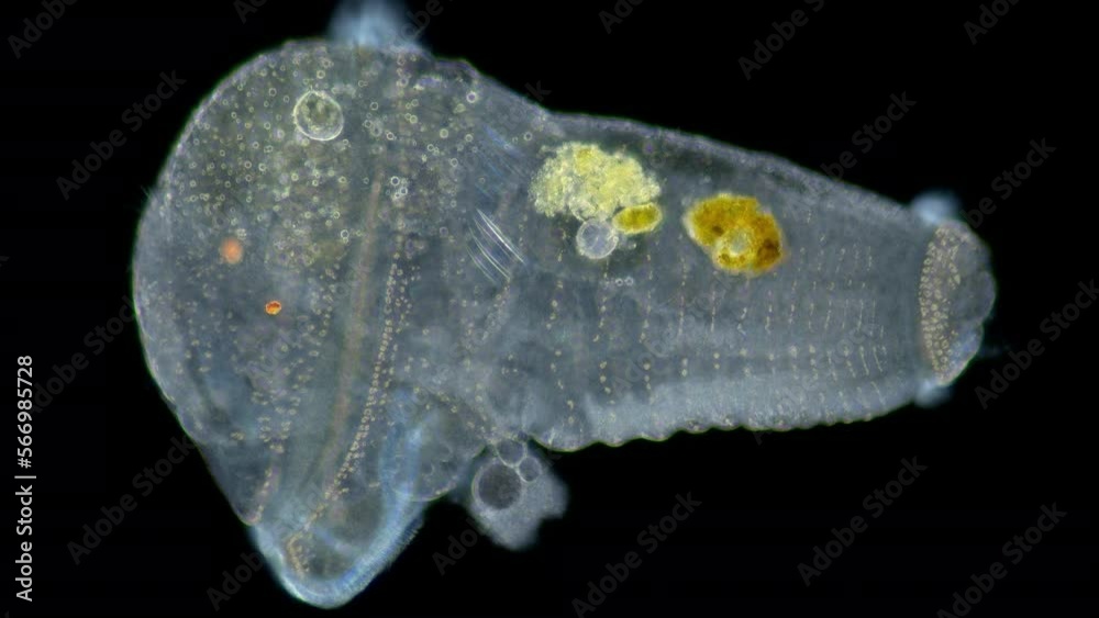Larva of a worm at metatrochophore stage under a microscope, of family ...