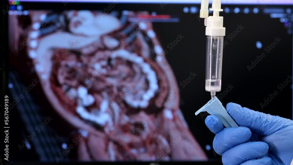 Doctor diagnosing a 3 dimensional anatomy model. Intravenous treatment ...