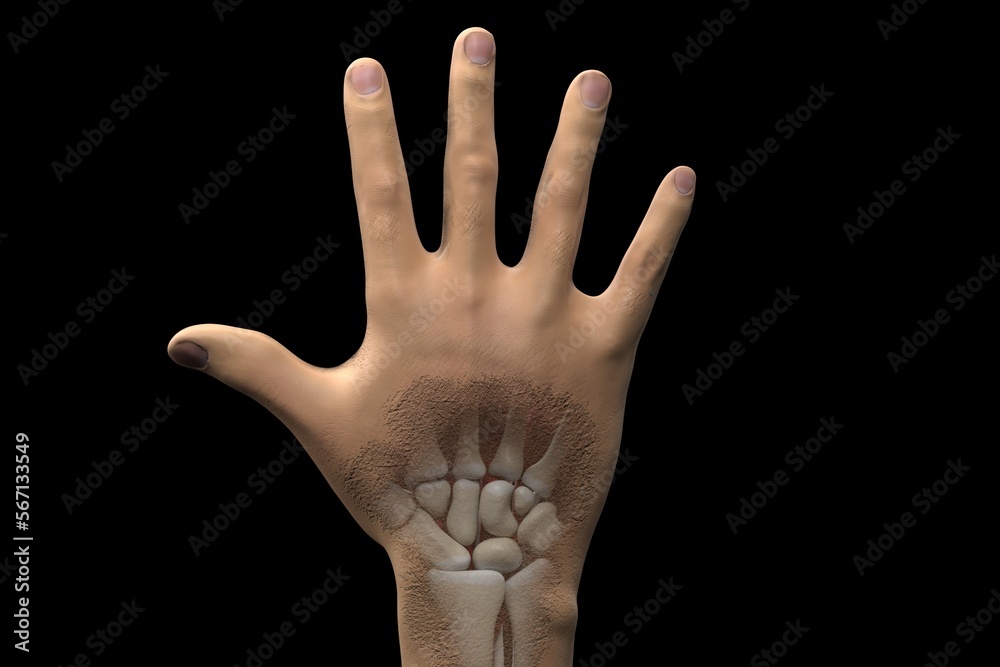 Dorsal view of a hand where its bones can be viewed. The anatomy of a ...