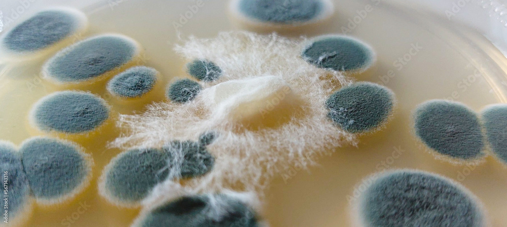 3d rendered illustration of bacteria, petri dish, fungus, contamination ...